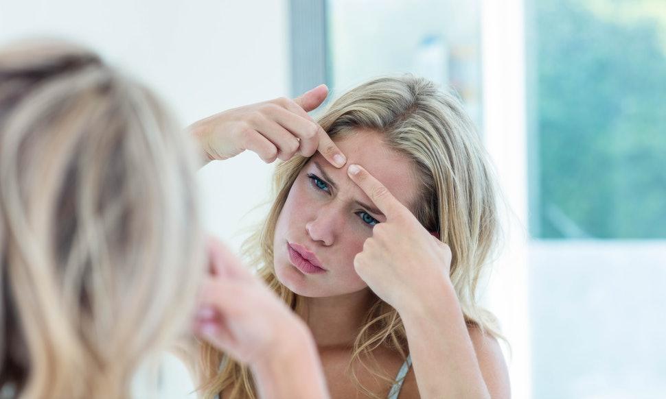 6 Daily Habits That Are The Cause of Your Acne Problem – I Love Facts